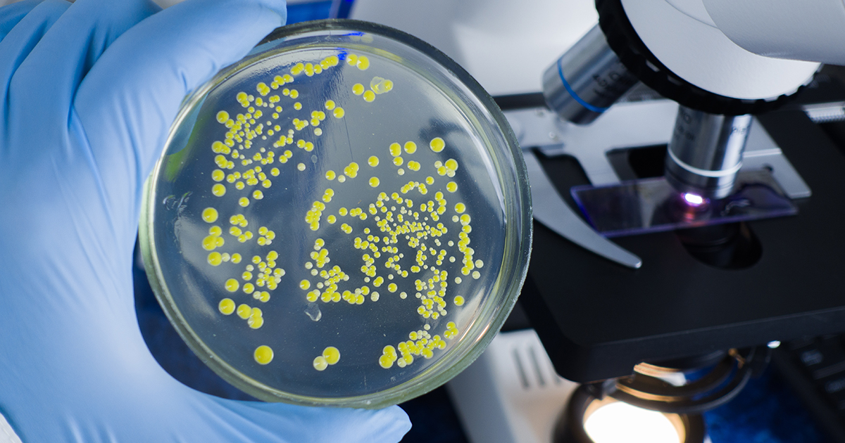 Particle Size Characterization - US edition MasterClass - Kindcongress